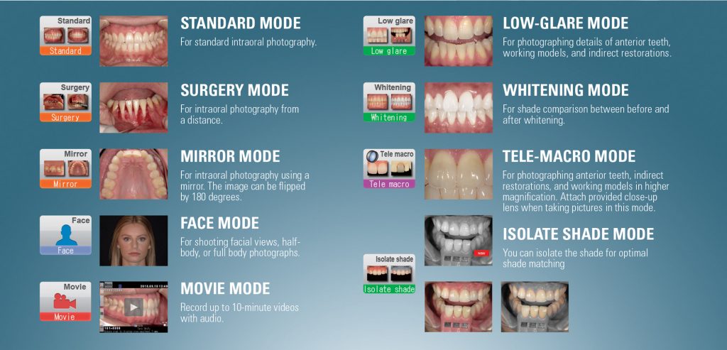 EyeSpecial – Shofu USA