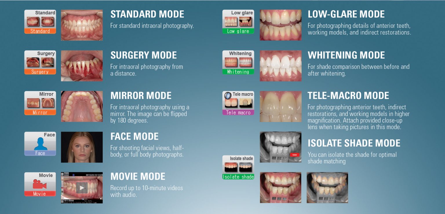 EyeSpecial – Shofu USA
