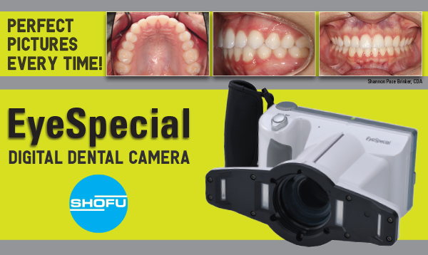 Request Demo | EyeSpecial – Shofu USA