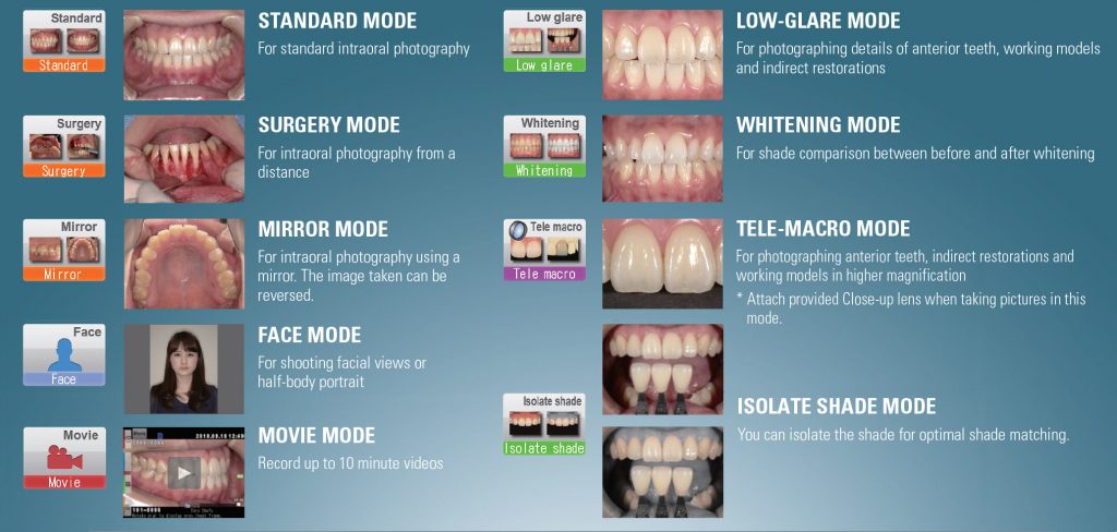 EyeSpecial 9 Step Mode - Shofu Global